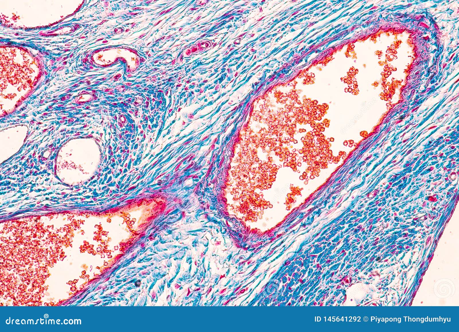 Student Learning Anatomy and Physiology of Ovary Under the Microscopic ...