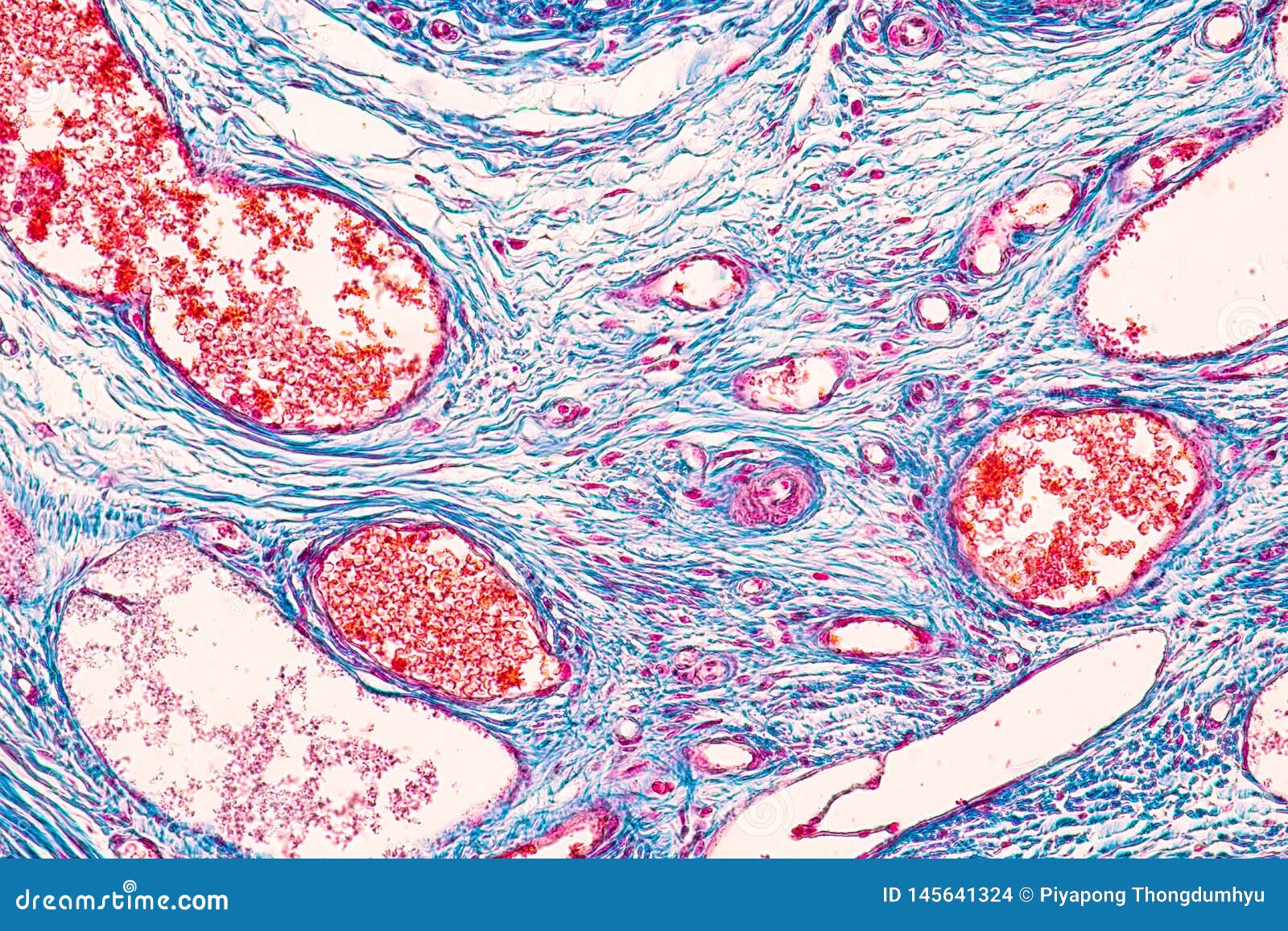 Student Learning Anatomy and Physiology of Ovary Under the Microscopic ...