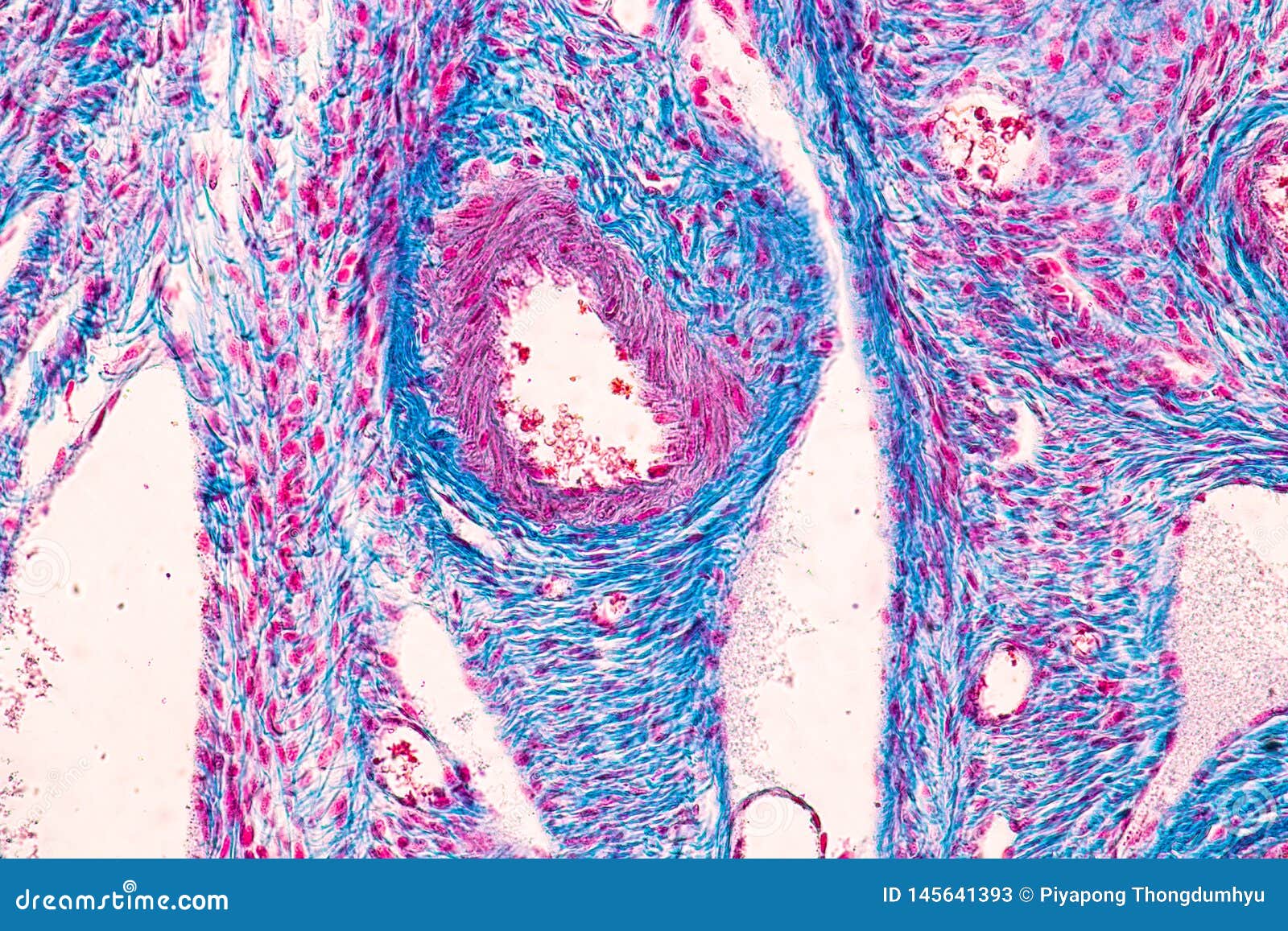 Student Learning Anatomy and Physiology of Ovary Under the Microscopic ...