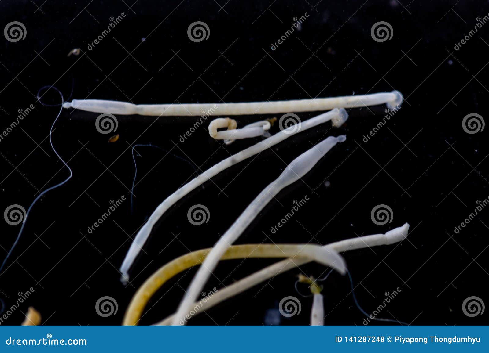 Acanthocephala is a Phylum of Parasitic Worms Known As Acanthocephalans ...