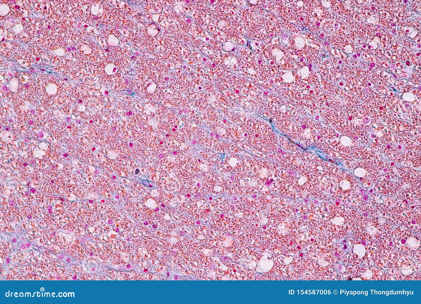 Study Anatomy Human and Histological Sample of Human Model. Stock Photo ...