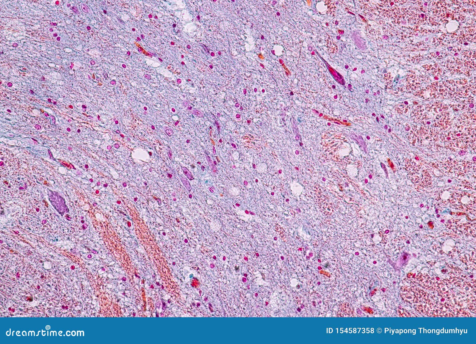 Study Anatomy Human and Histological Sample of Human Model. Stock Photo ...