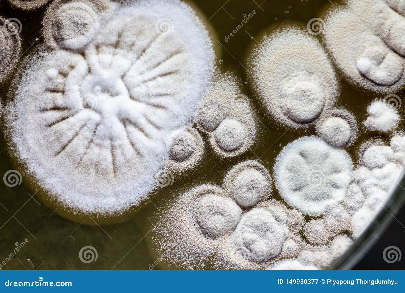 Study Colony Characteristic Of Actinomyces, Bacteria, Yeast And Mold On ...
