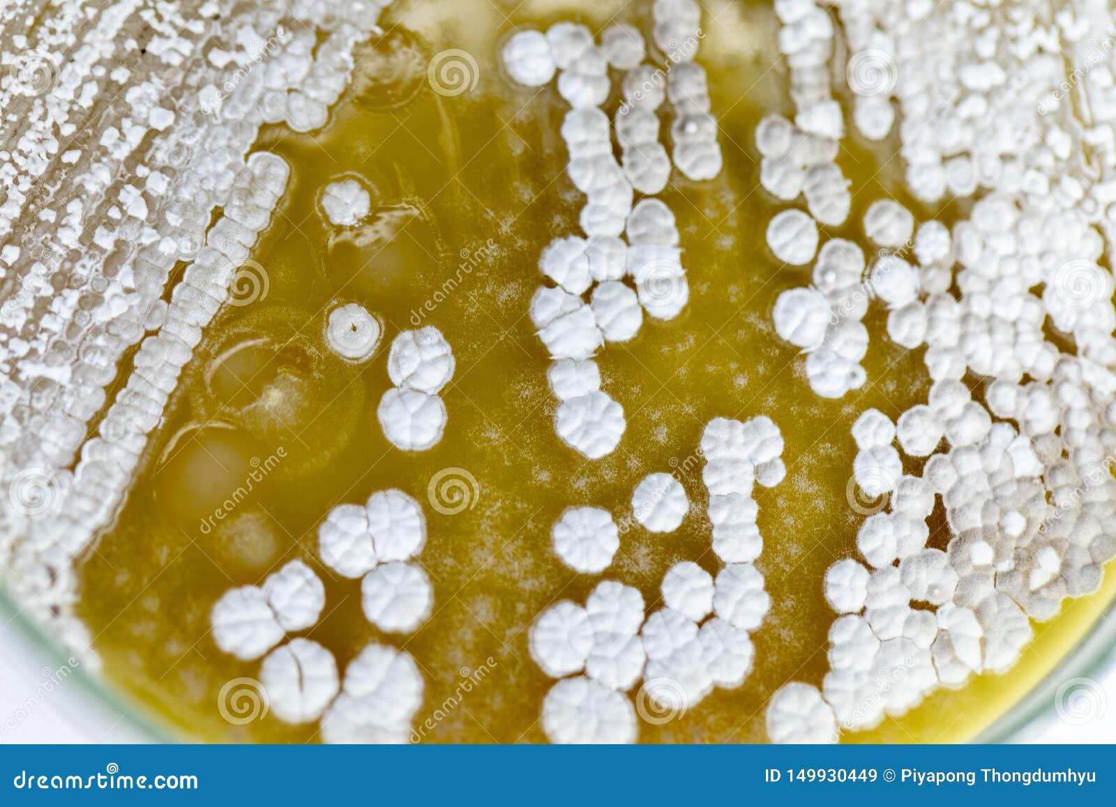 Study Colony Characteristic Of Actinomyces, Bacteria, Yeast And Mold On ...