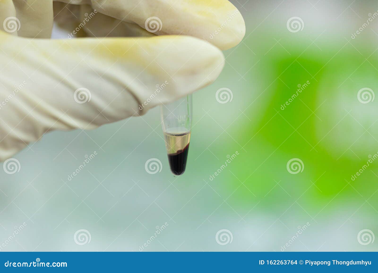 Study of Fish Blood Composition. Stock Photo - Image of antibiotic ...