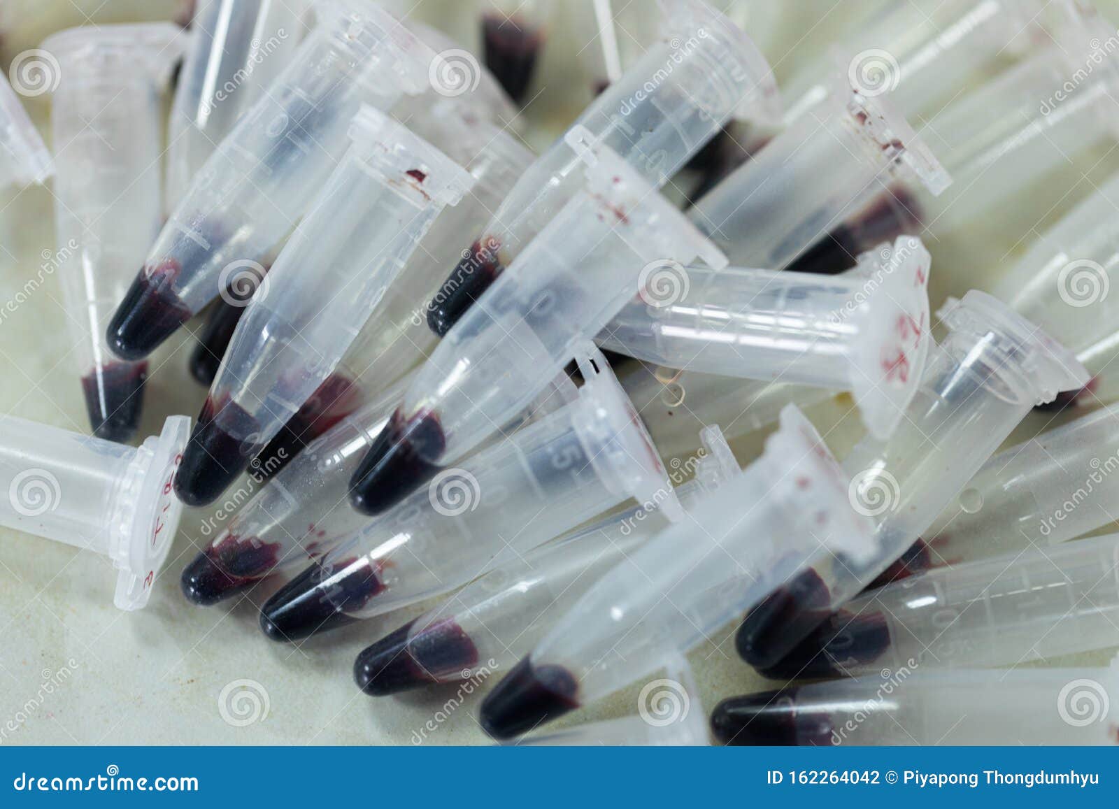 Study of Fish Blood Composition. Stock Photo - Image of chemical ...