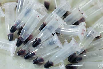 Study of Fish Blood Composition. Stock Photo - Image of chemical ...