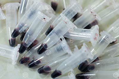 Study of Fish Blood Composition. Stock Photo - Image of chemical ...