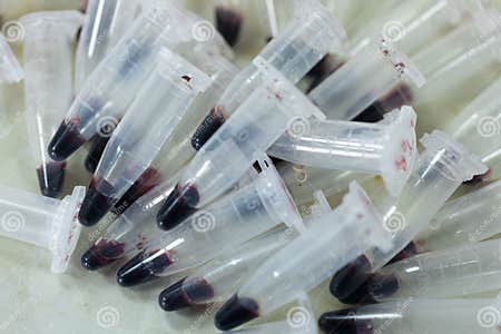 Study of Fish Blood Composition. Stock Photo - Image of chemical ...