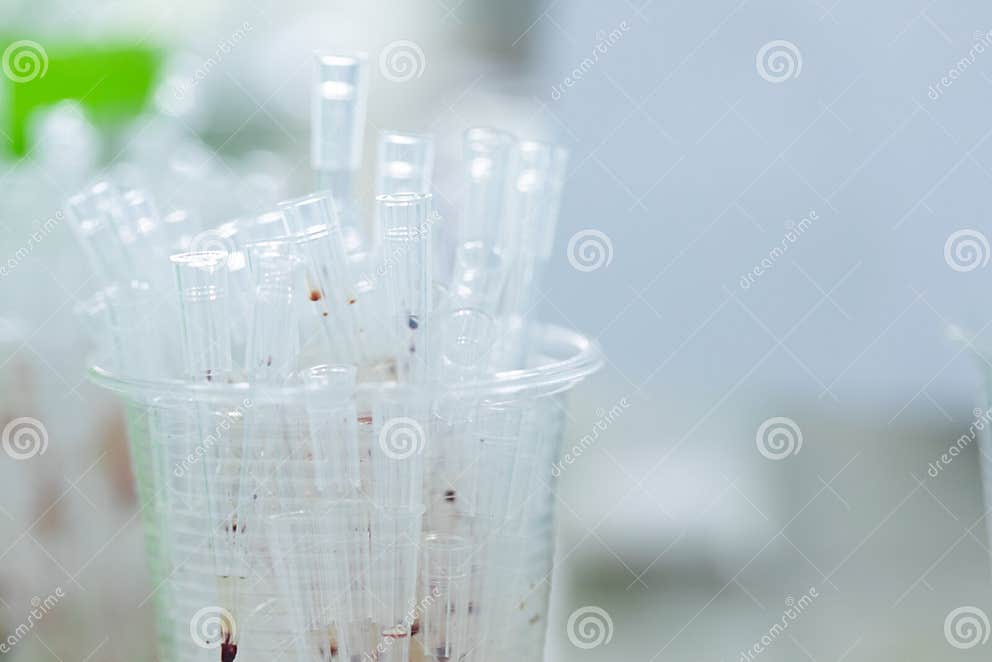 Study of Fish Blood Composition. Stock Photo - Image of analysis ...