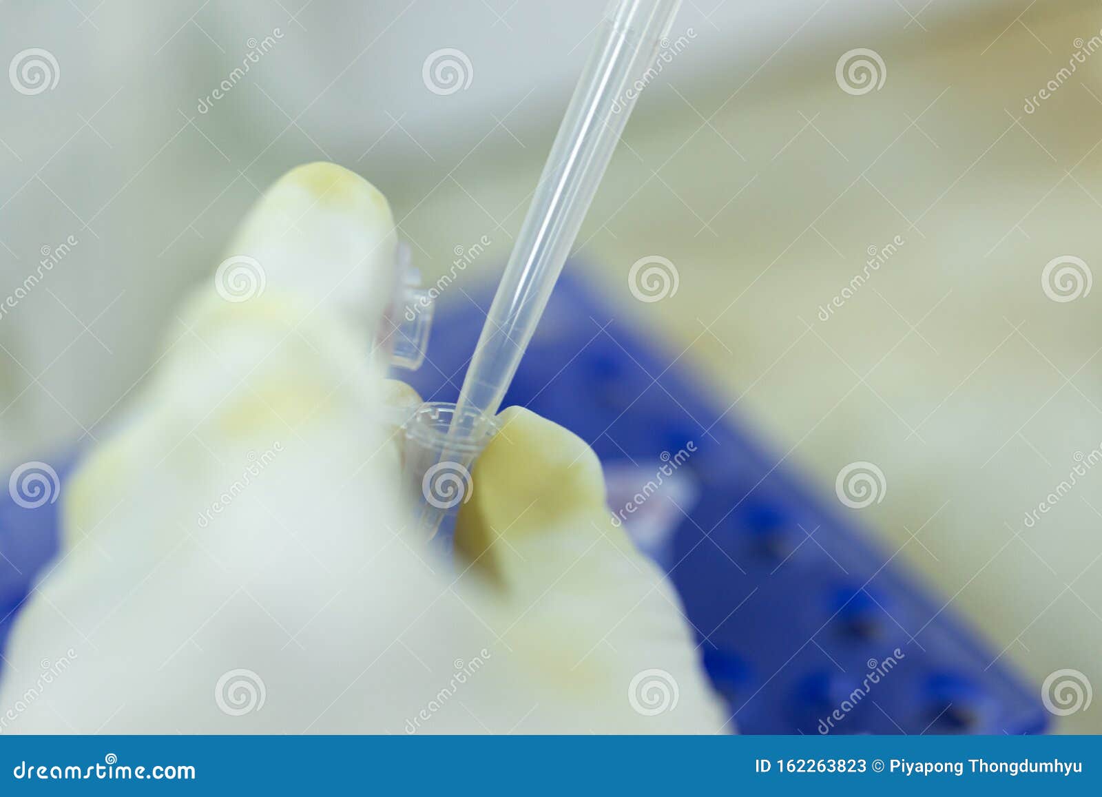 Fish Blood Smear, Erythrocytes With Micronucleus, 80X Light Micrograph ...