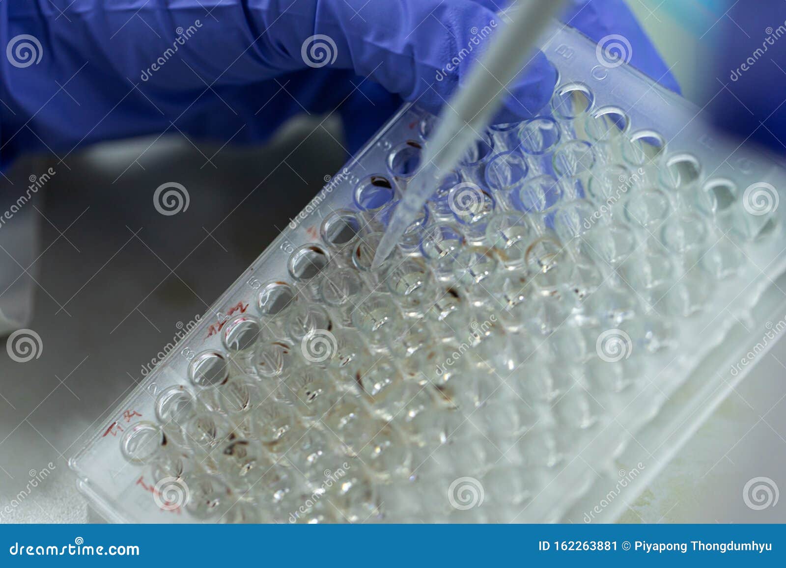 Fish Blood Smear, Erythrocytes With Micronucleus, 80X Light Micrograph ...