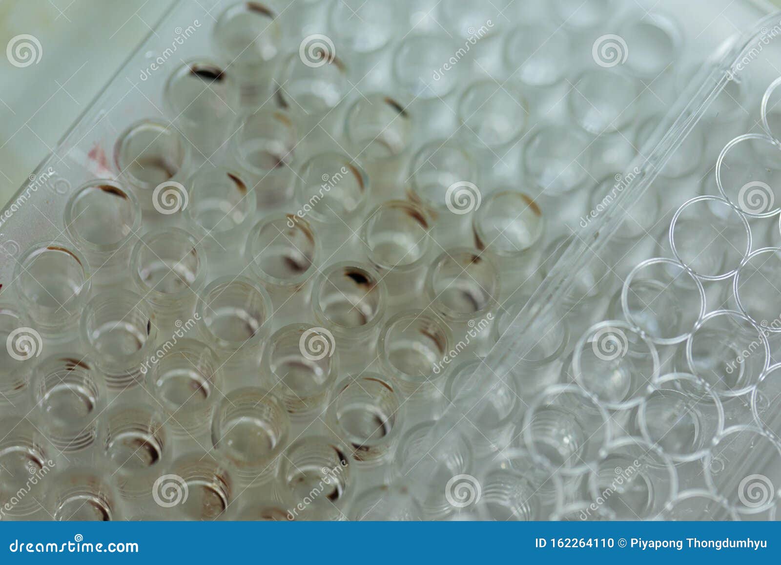 Study of Fish Blood Composition. Stock Photo - Image of biological ...