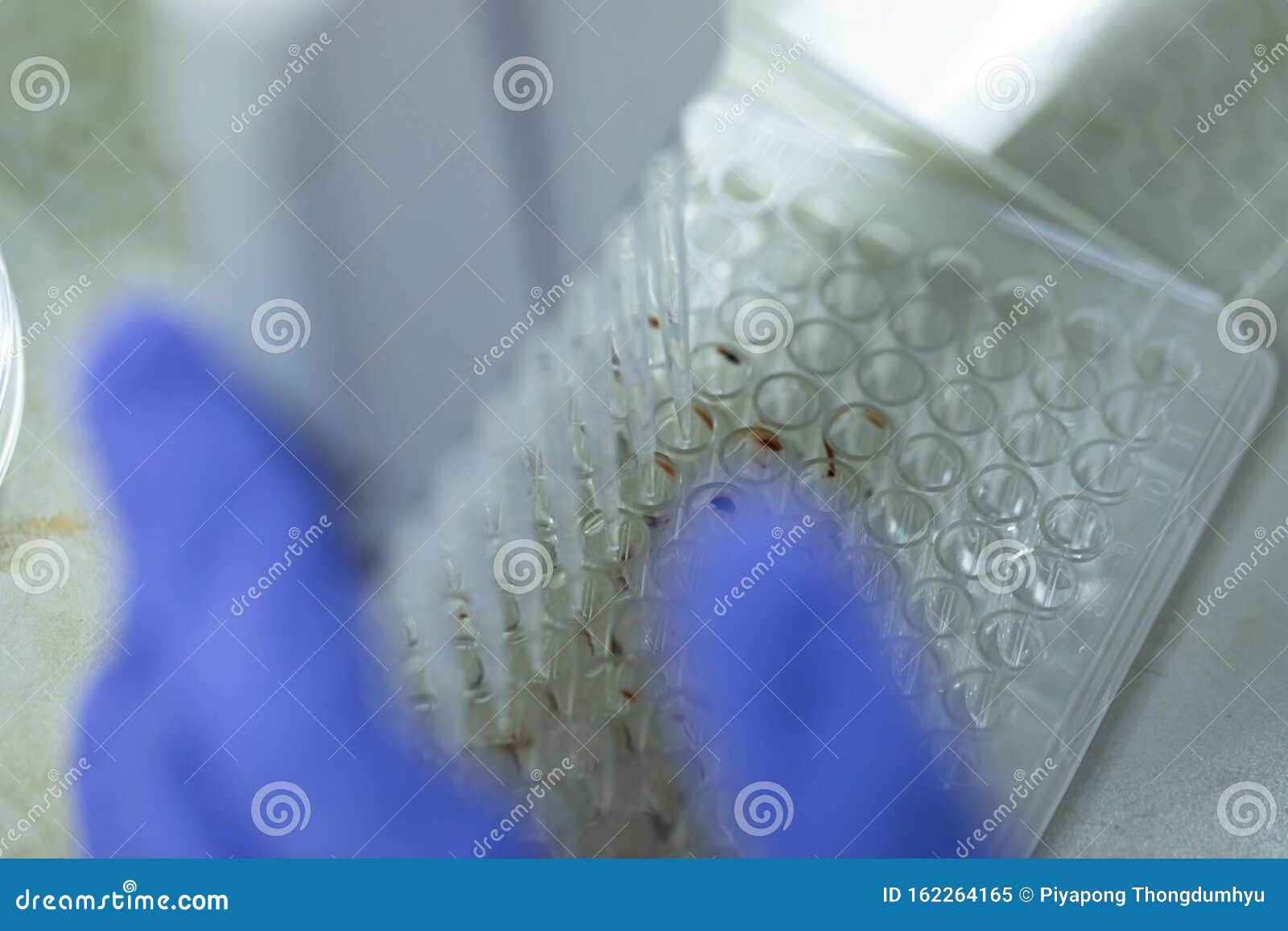 Study of Fish Blood Composition. Stock Image - Image of immunoglobulin ...
