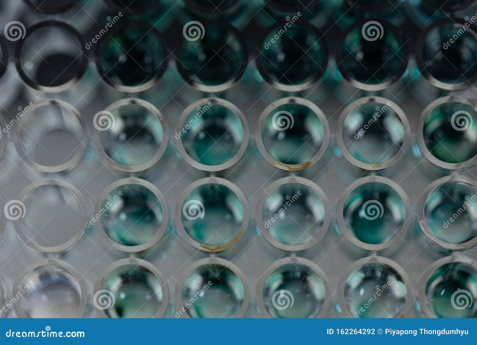 Study of Fish Blood Composition. Stock Photo - Image of blood ...