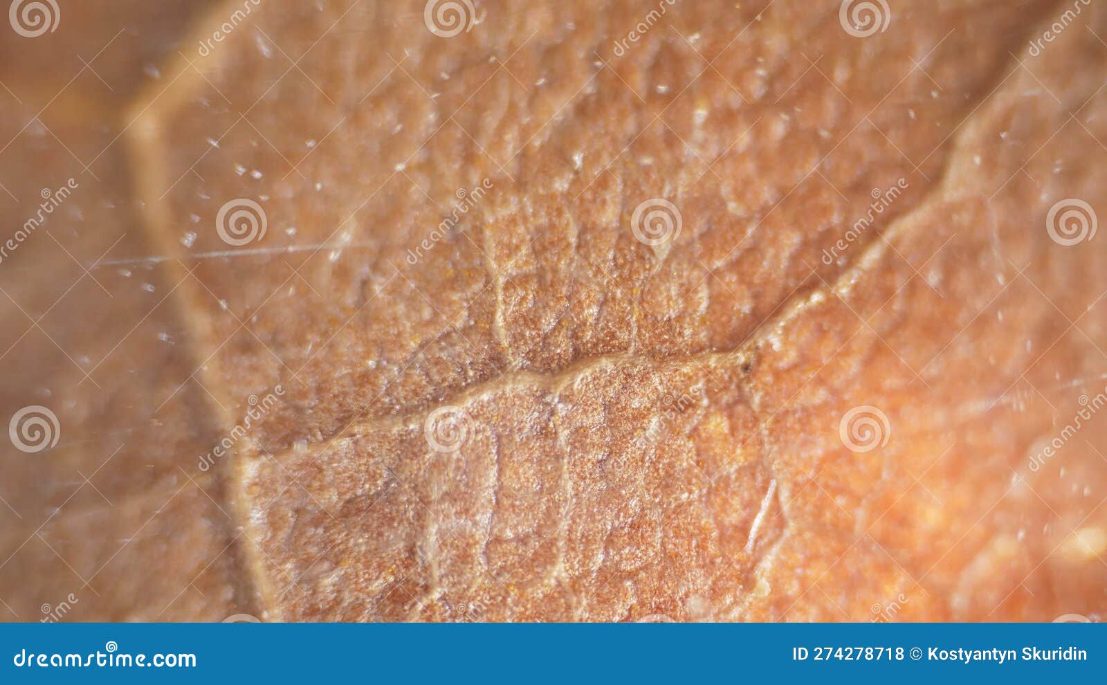 Study of a Genetic Sample. the Structure of a Dry Leaf of a Plant Under ...