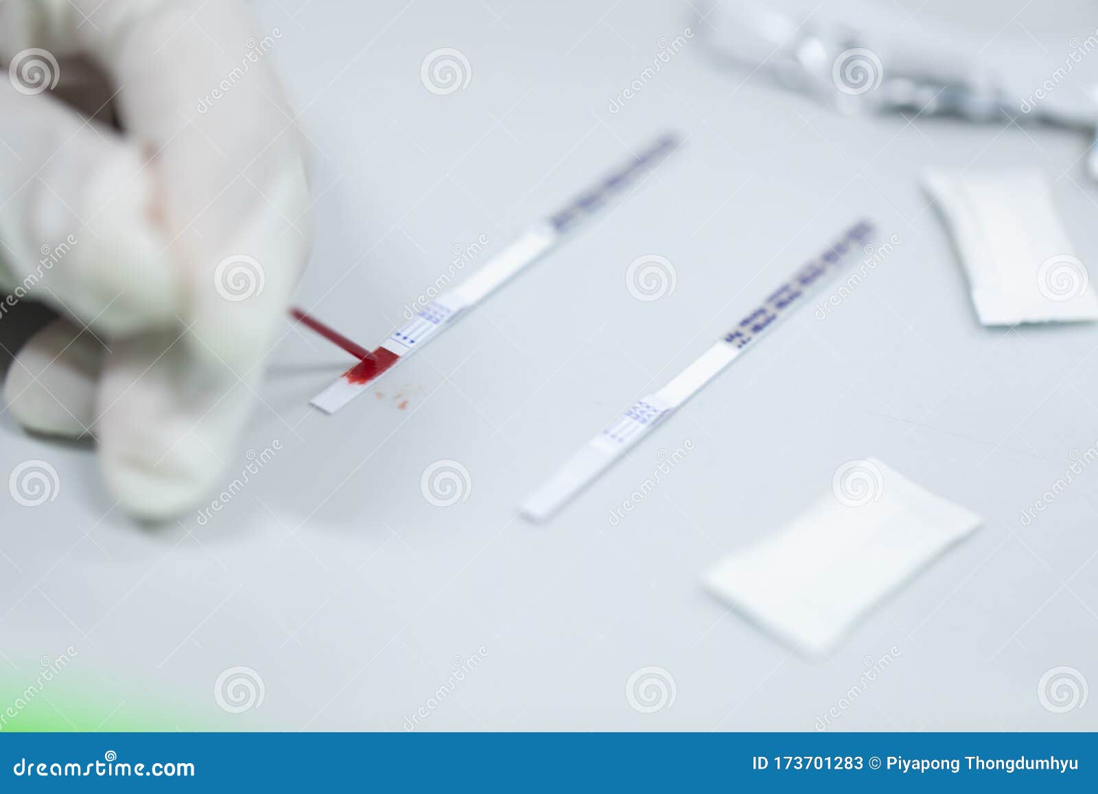 Study of Hepatitis-B Detection. Stock Image - Image of laboratoriesn ...