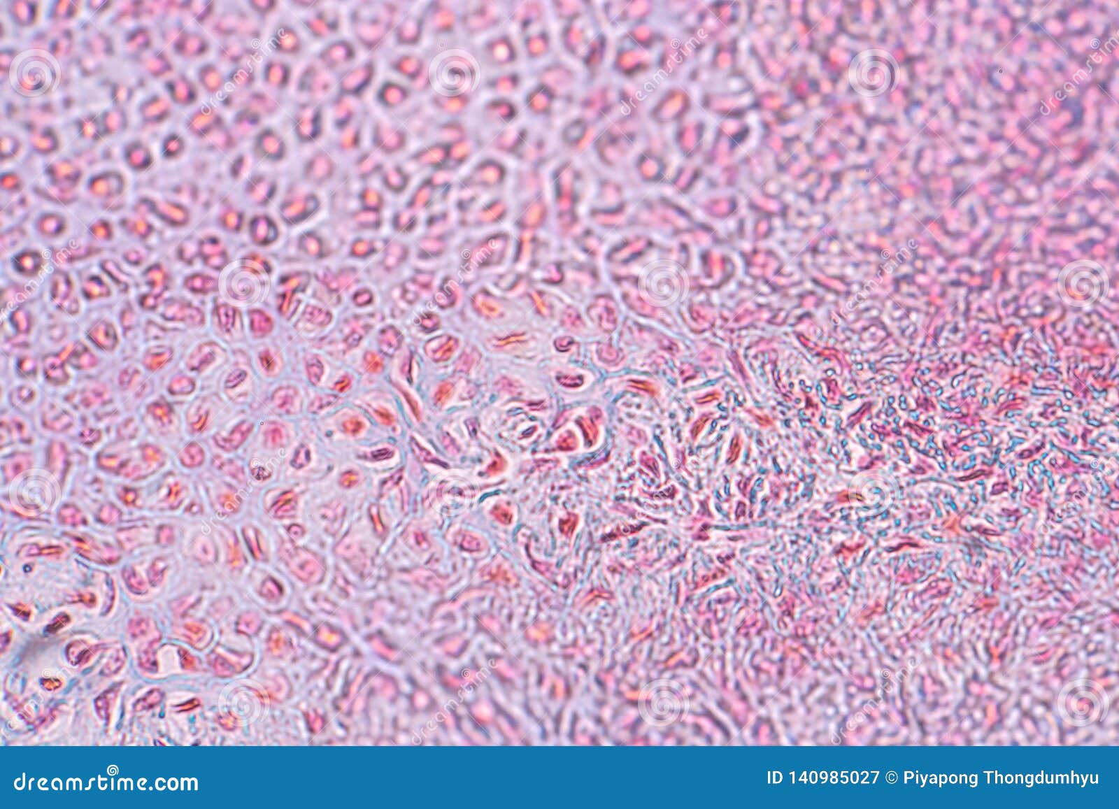 Study Histology of Human, Tissue Bone Under the Microscopic. Stock ...