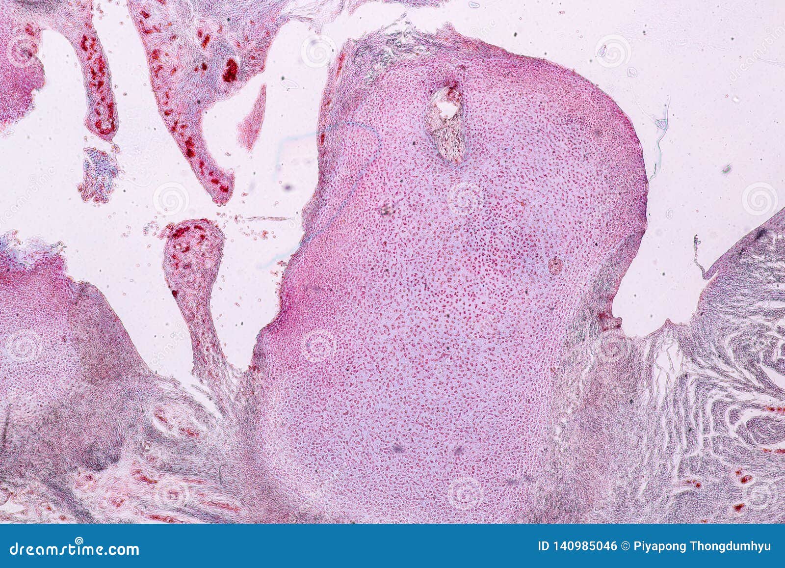 Study Histology of Human, Tissue Bone Under the Microscopic. Stock ...