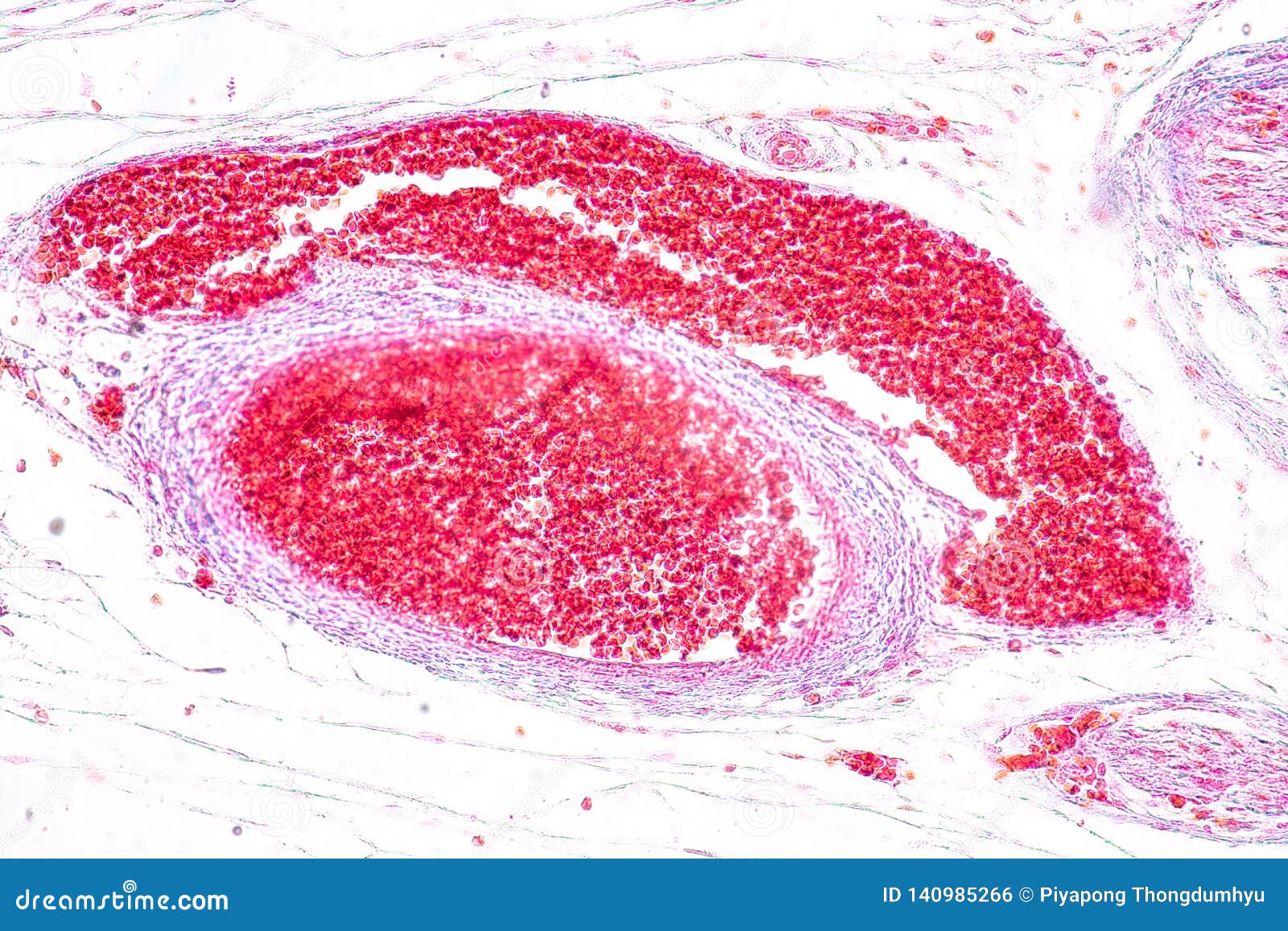 Study Histology of Human, Tissue Bone Under the Microscopic. Stock ...