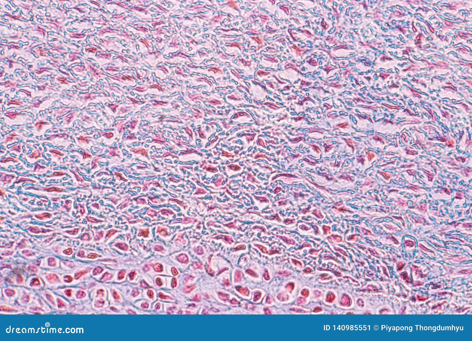 Study Histology of Human, Tissue Bone Under the Microscopic. Stock ...