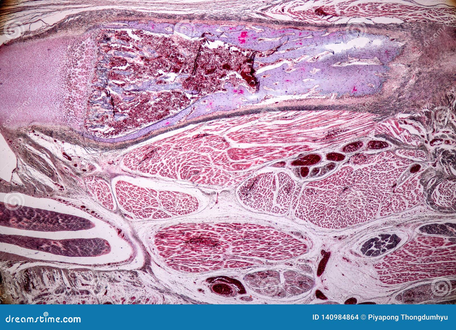 Study Histology of Human, Tissue Bone Under the Microscopic. Stock ...