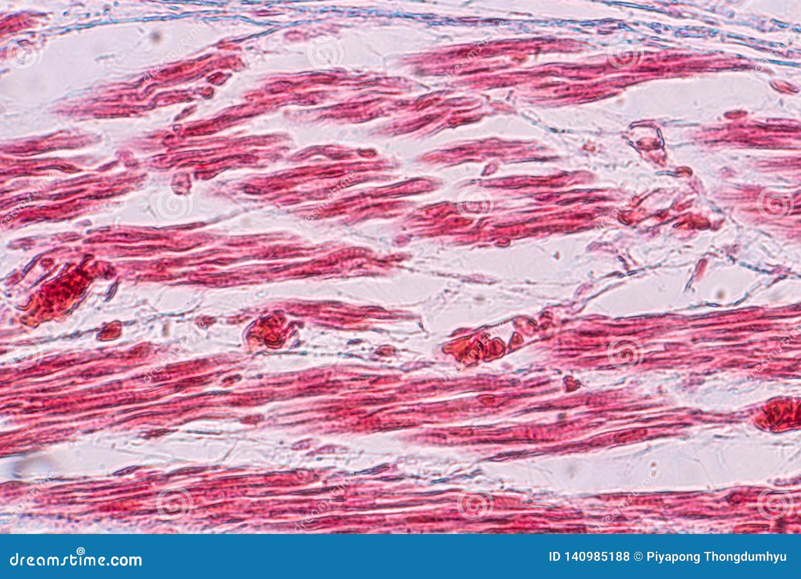 Study Histology of Human, Tissue Bone Under the Microscopic. Stock ...