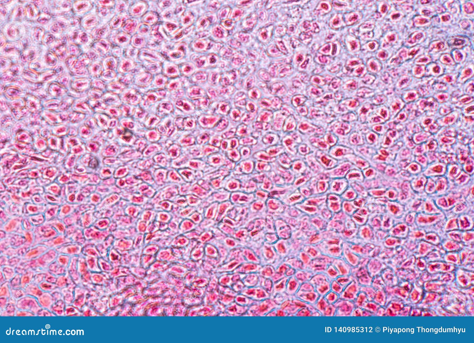 Study Histology of Human, Tissue Bone Under the Microscopic. Stock ...
