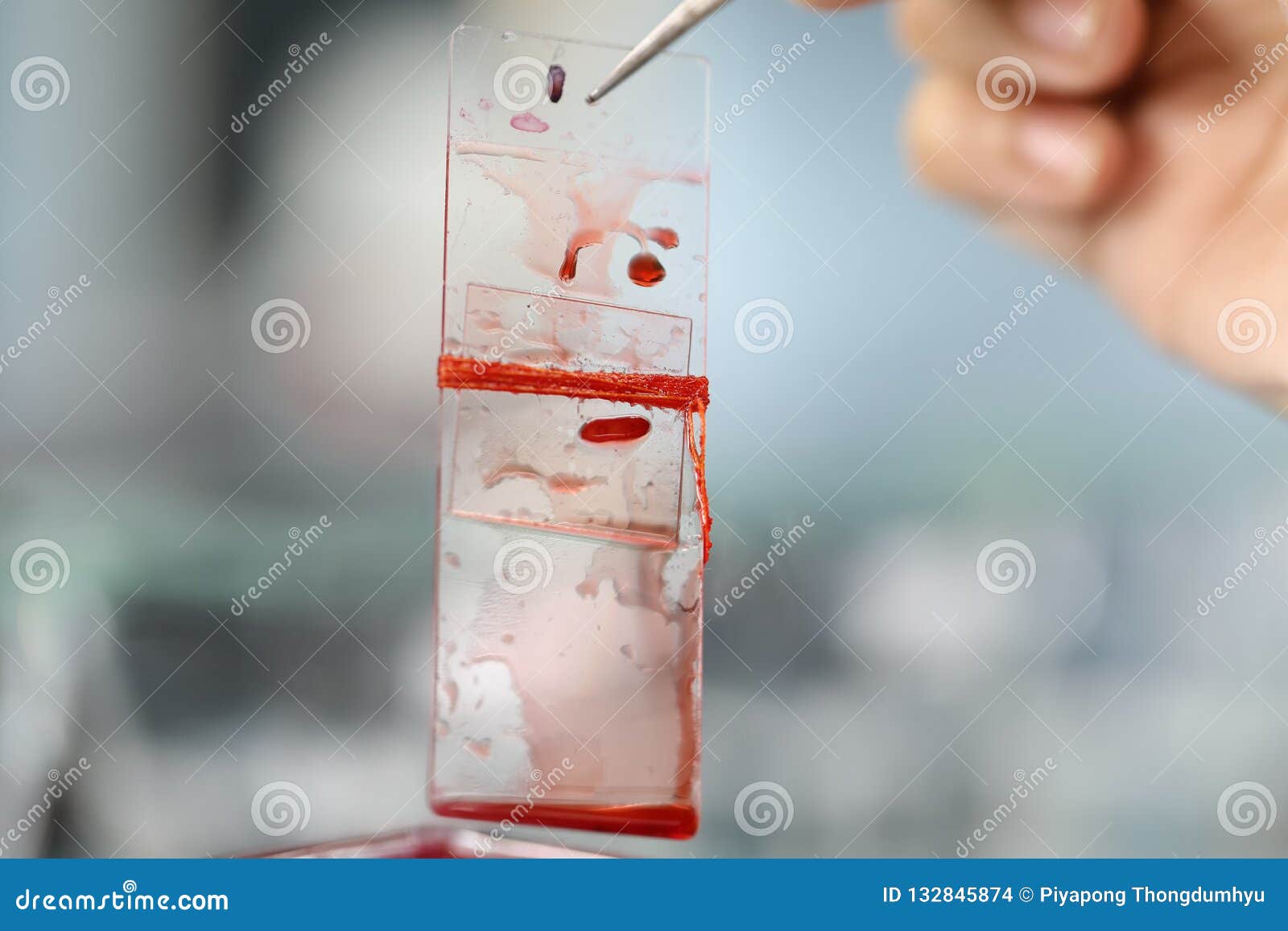 Parasite or Worms is a Freshwater Fish Parasite in Laboratory for ...