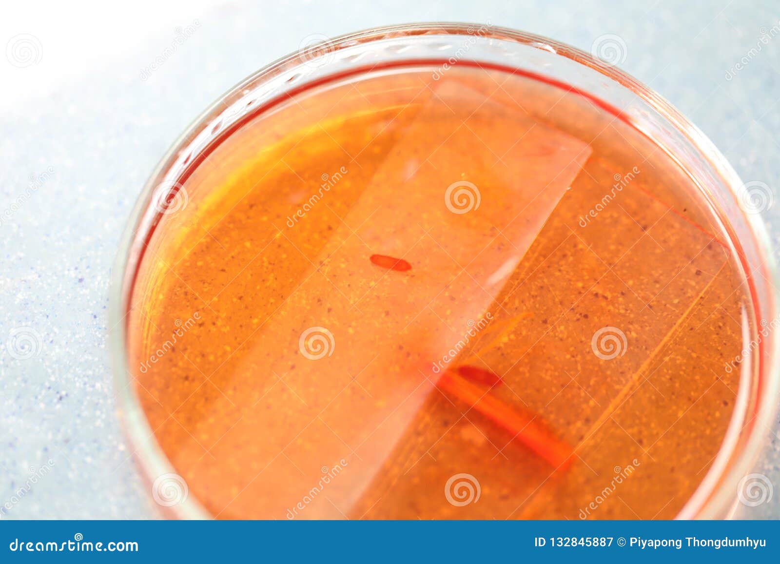 Parasite or Worms is a Freshwater Fish Parasite in Laboratory for ...