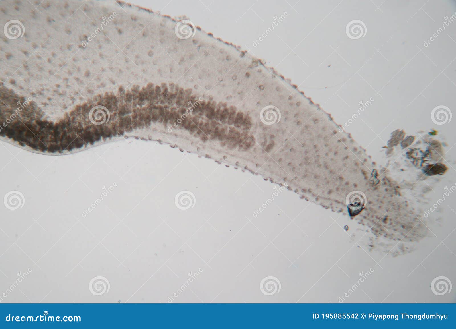 The Study Parasite or Worms is a Freshwater Fish Parasite in Laboratory ...