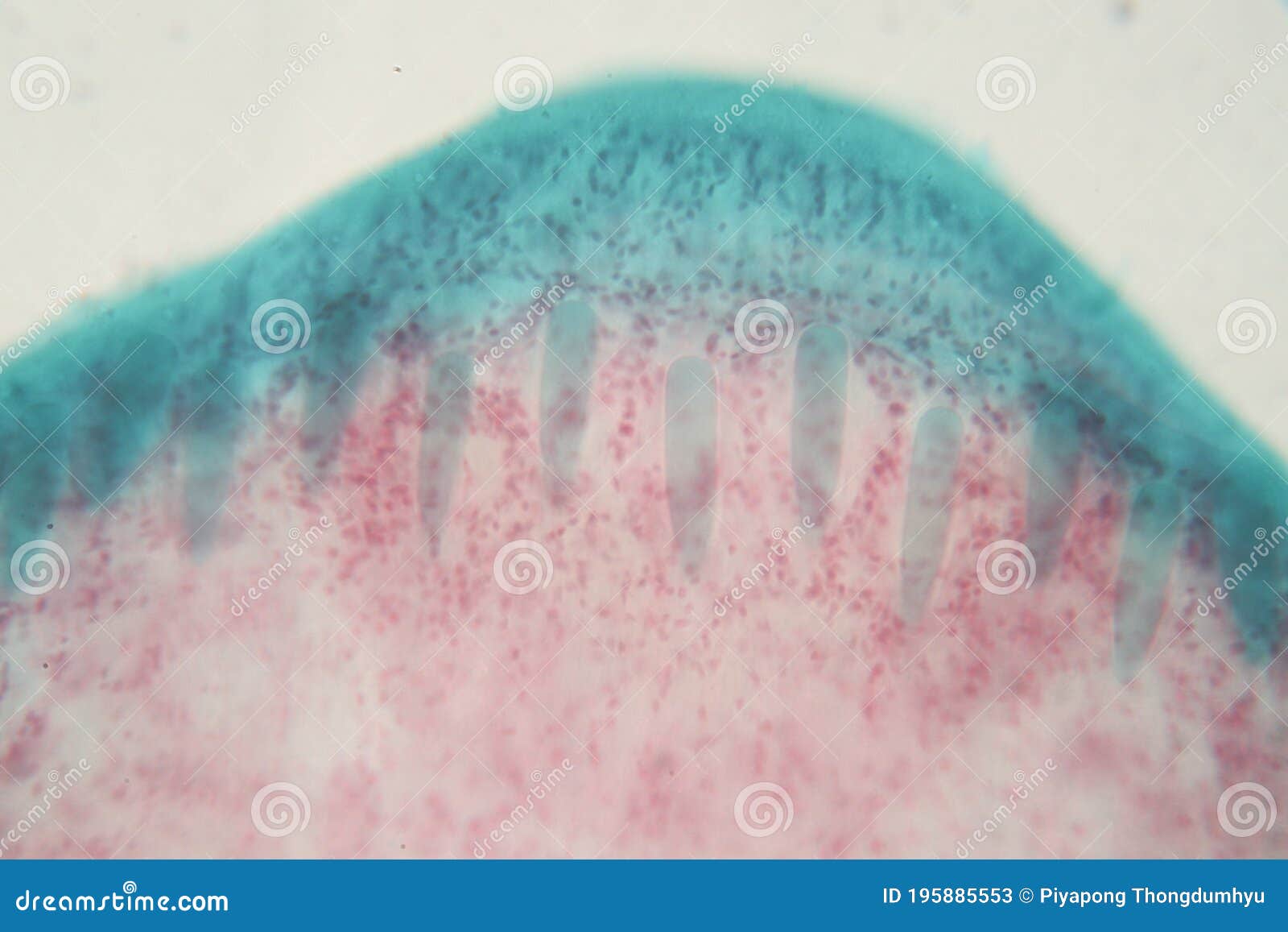 The Study Parasite or Worms is a Freshwater Fish Parasite in Laboratory ...