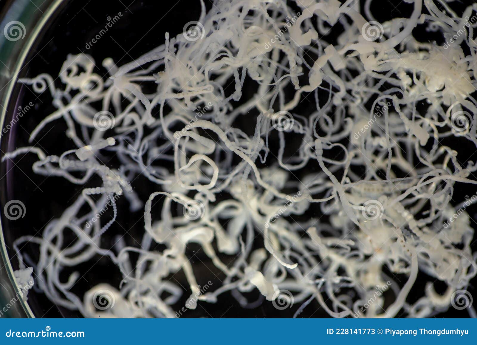 The Study Parasite or Worms is a Freshwater Fish Parasite in Laboratory ...