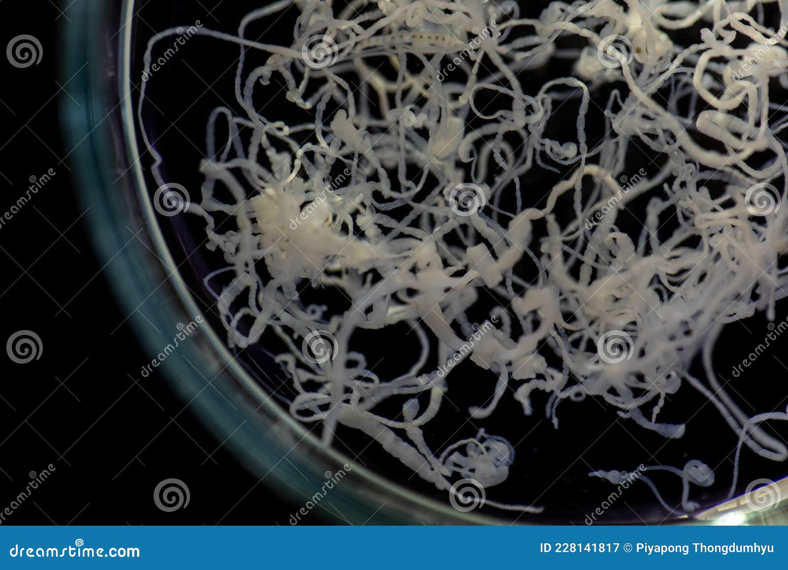The Study Parasite or Worms is a Freshwater Fish Parasite in Laboratory ...