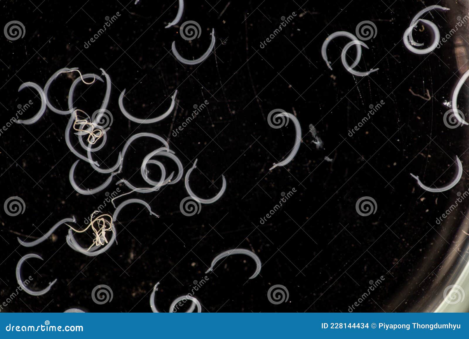 The Study Parasite or Worms is a Freshwater Fish Parasite in Laboratory ...