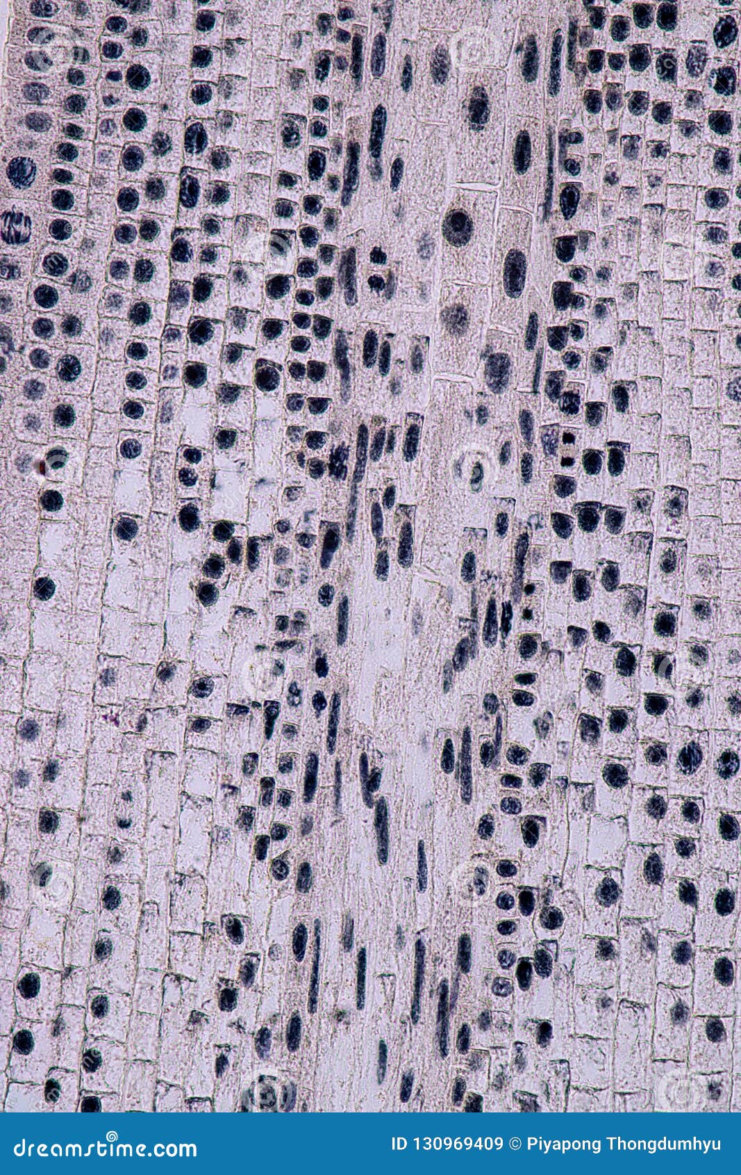 Root Tip of Onion and Mitosis Cell in the Root Tip of Onion Under a ...