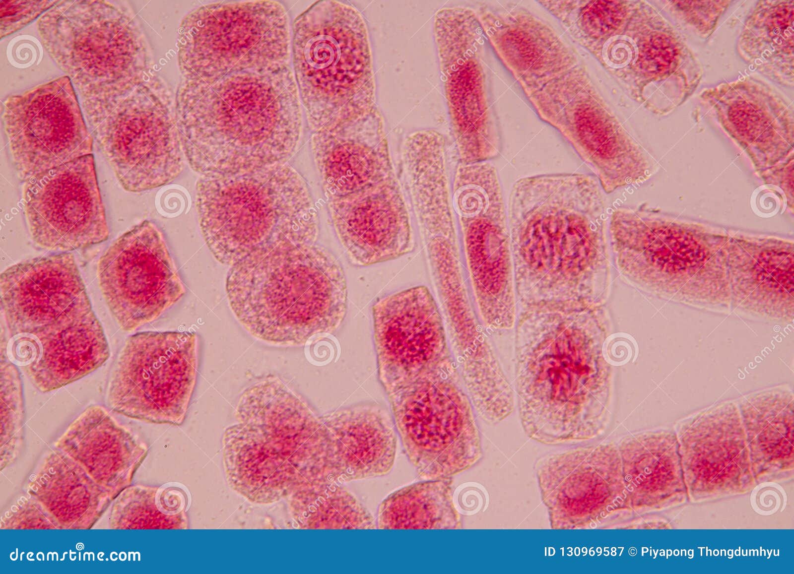 Root Tip of Onion and Mitosis Cell in the Root Tip of Onion Under a ...