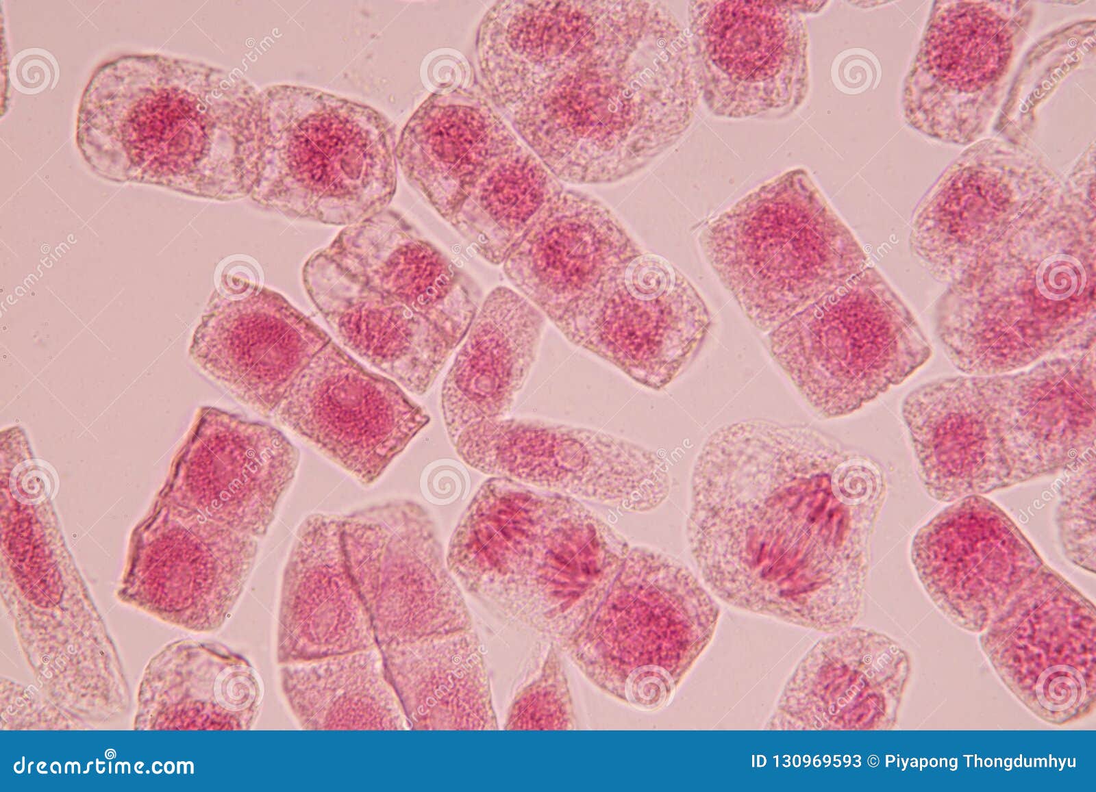 Root Tip Of Onion And Mitosis Cell In The Root Tip Of Onion Under A ...