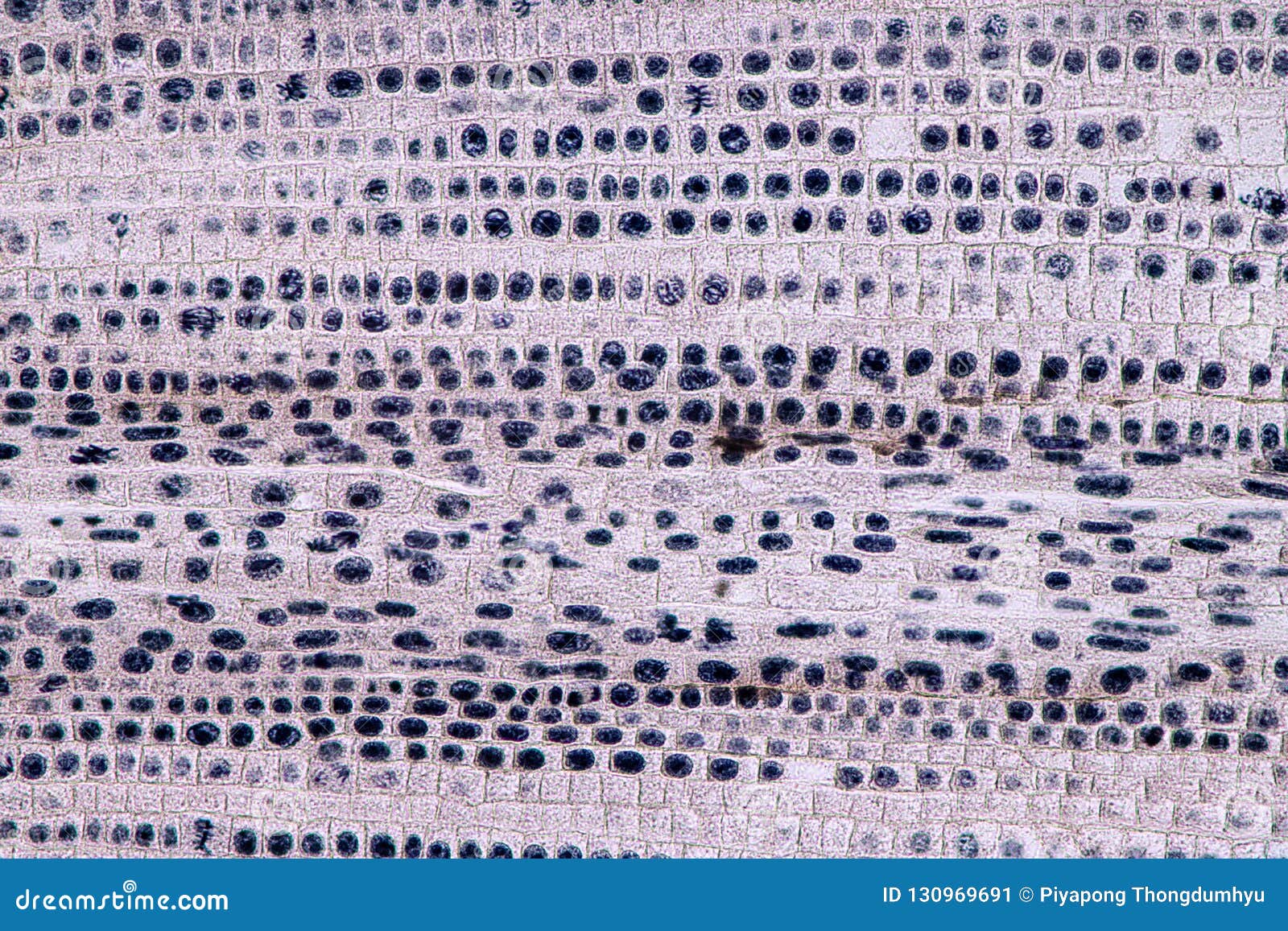 Root Tip of Onion and Mitosis Cell in the Root Tip of Onion Under a ...