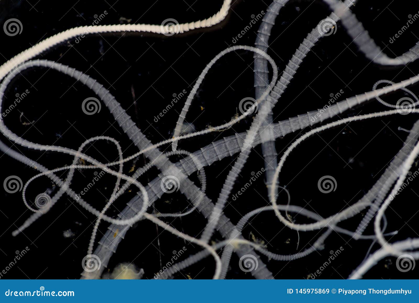 Tapeworm Infection is Caused by Ingesting Food or Water Contaminated ...