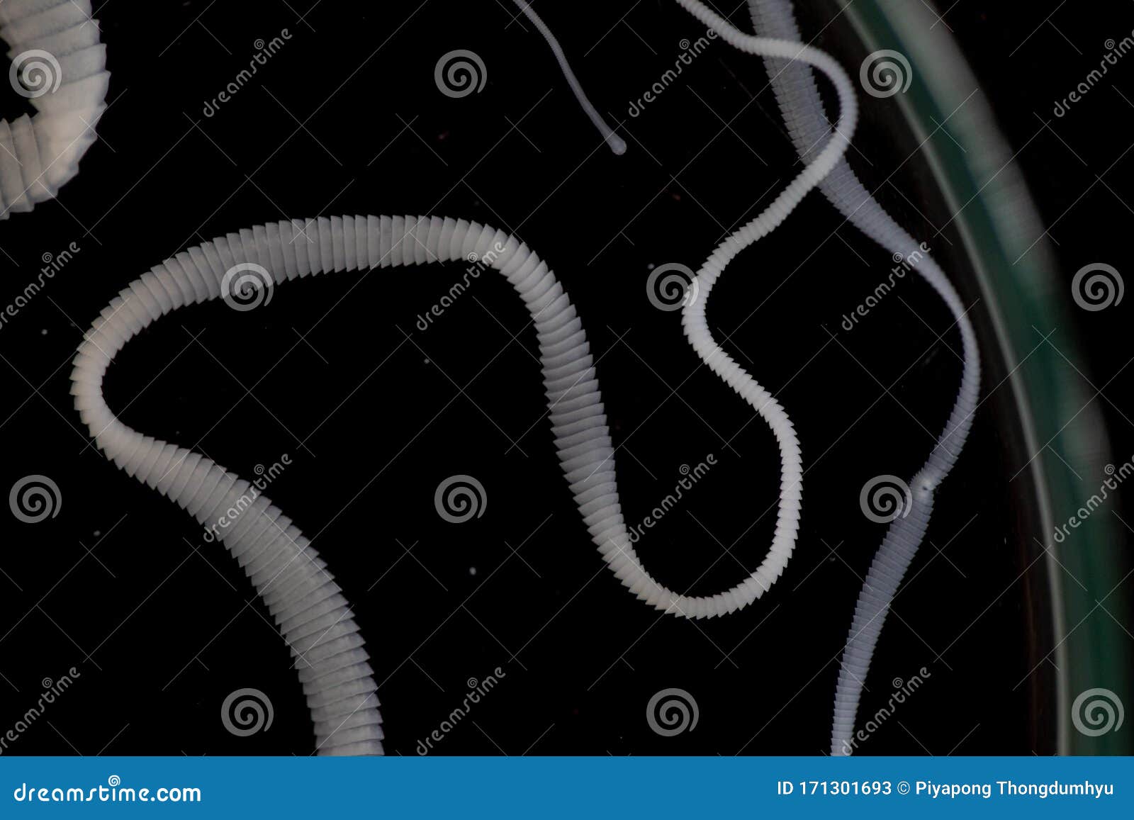 The Study of Tapeworm Infection is Caused by Ingesting Food or Water ...