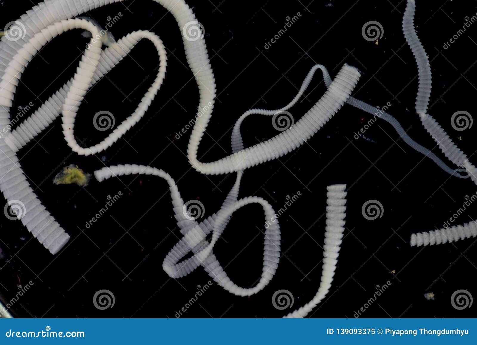 How does a sponge obtain food how does a tapeworm move - deluxewqp