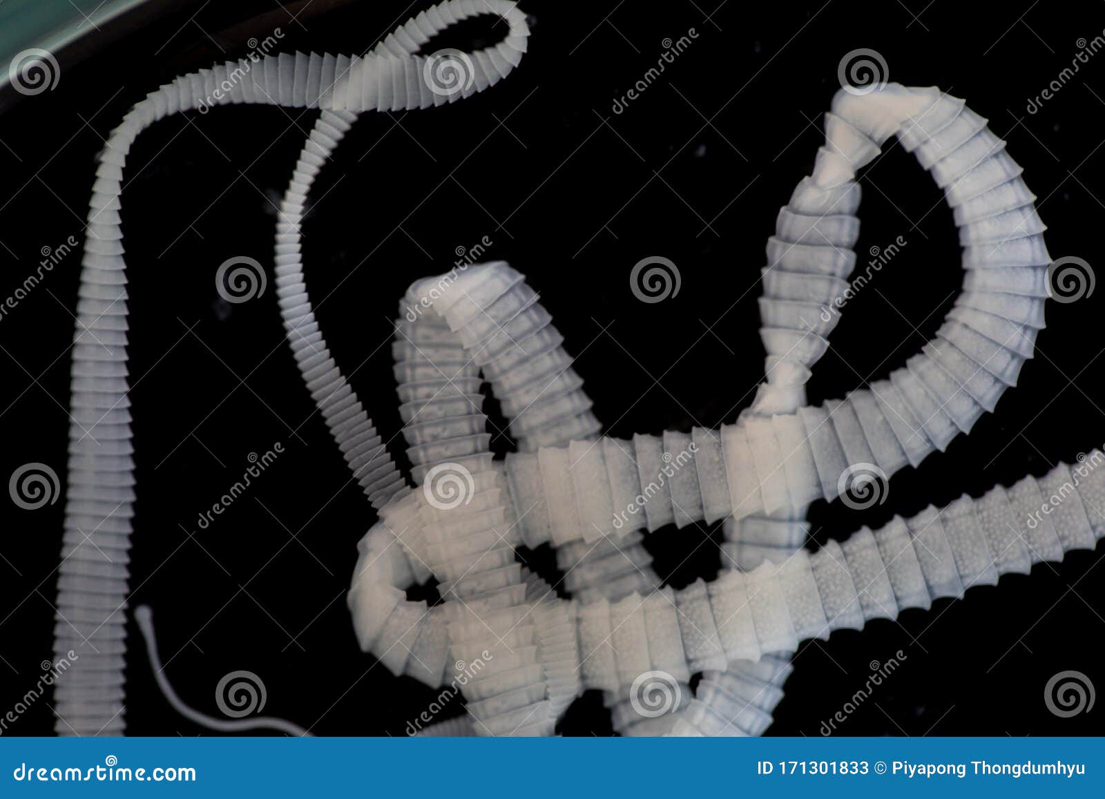 The Study of Tapeworm Infection is Caused by Ingesting Food or Water ...