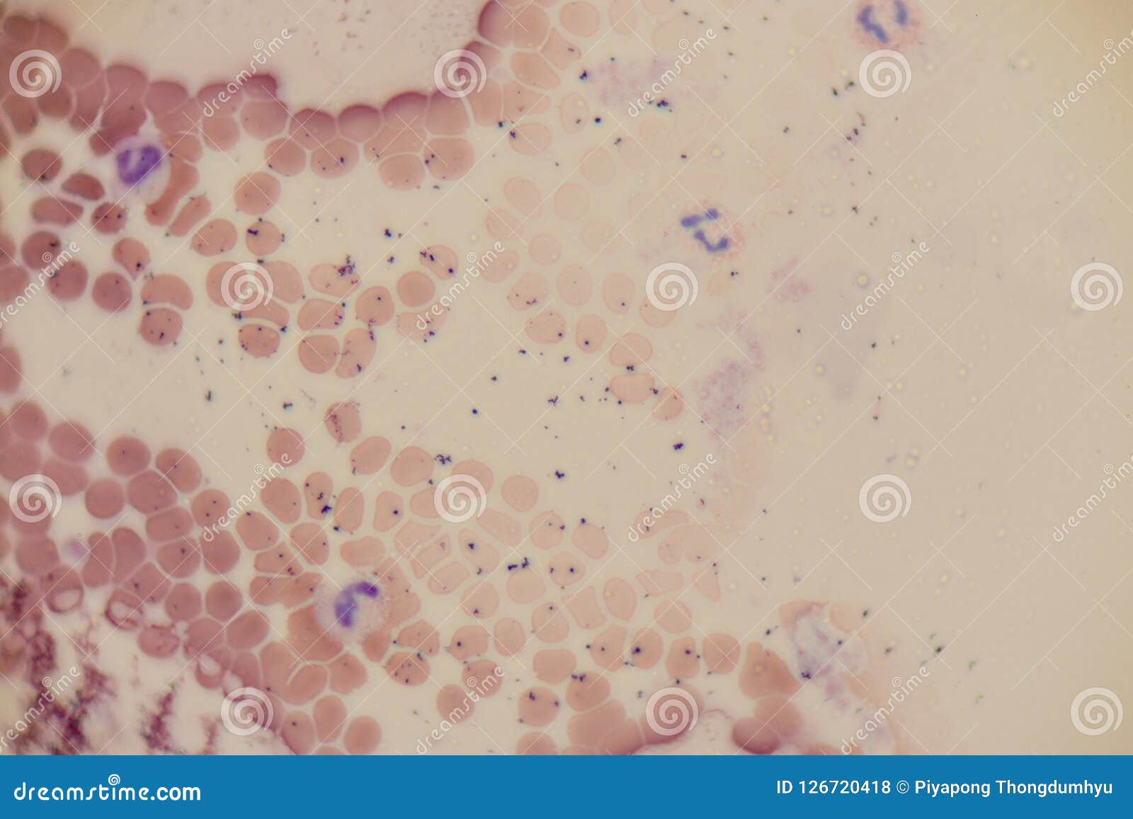 Study of White Blood Cells are the Cells of the Immune System Under the ...