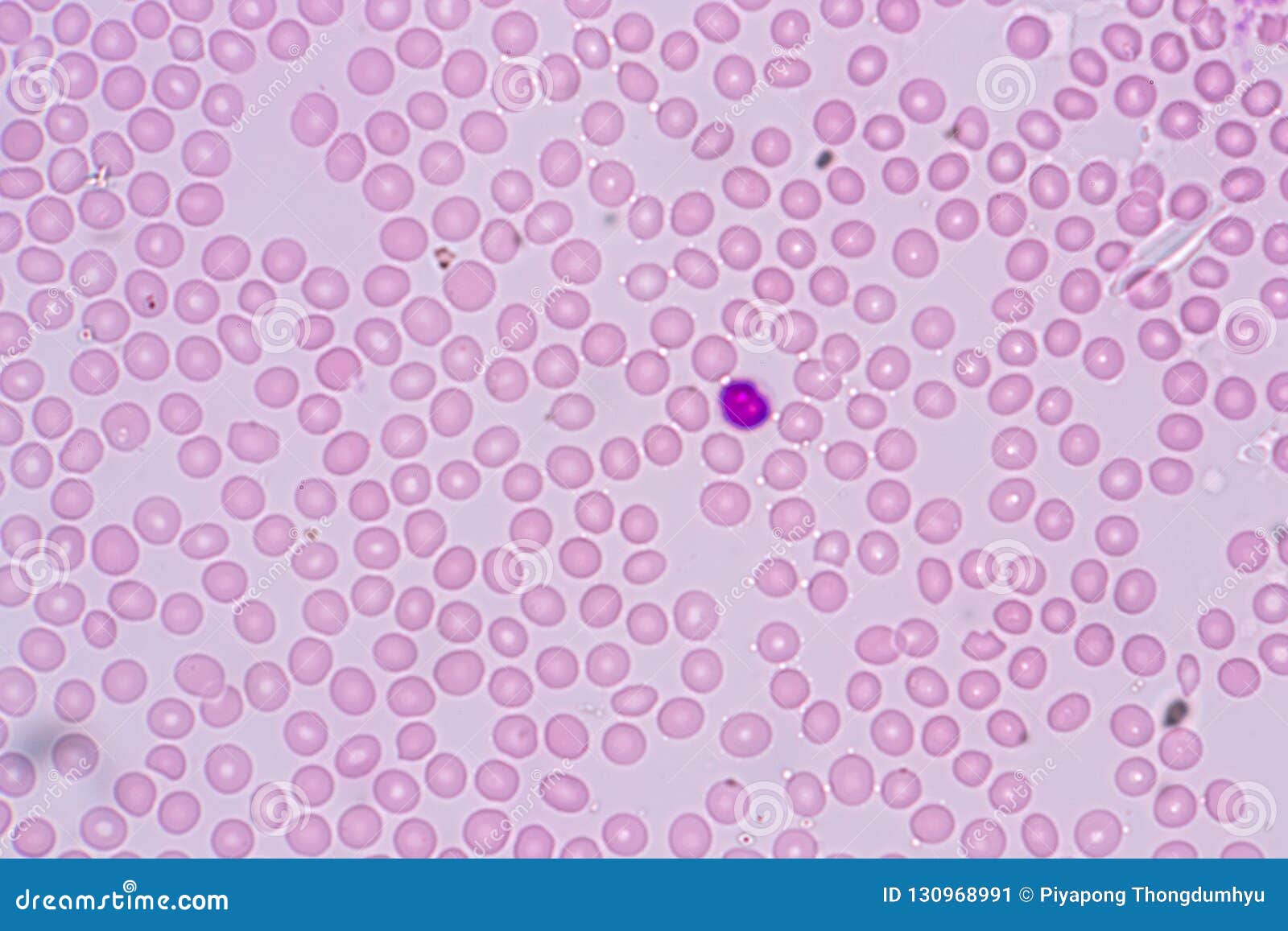 White Blood Cells are the Cells of the Immune System Under the ...