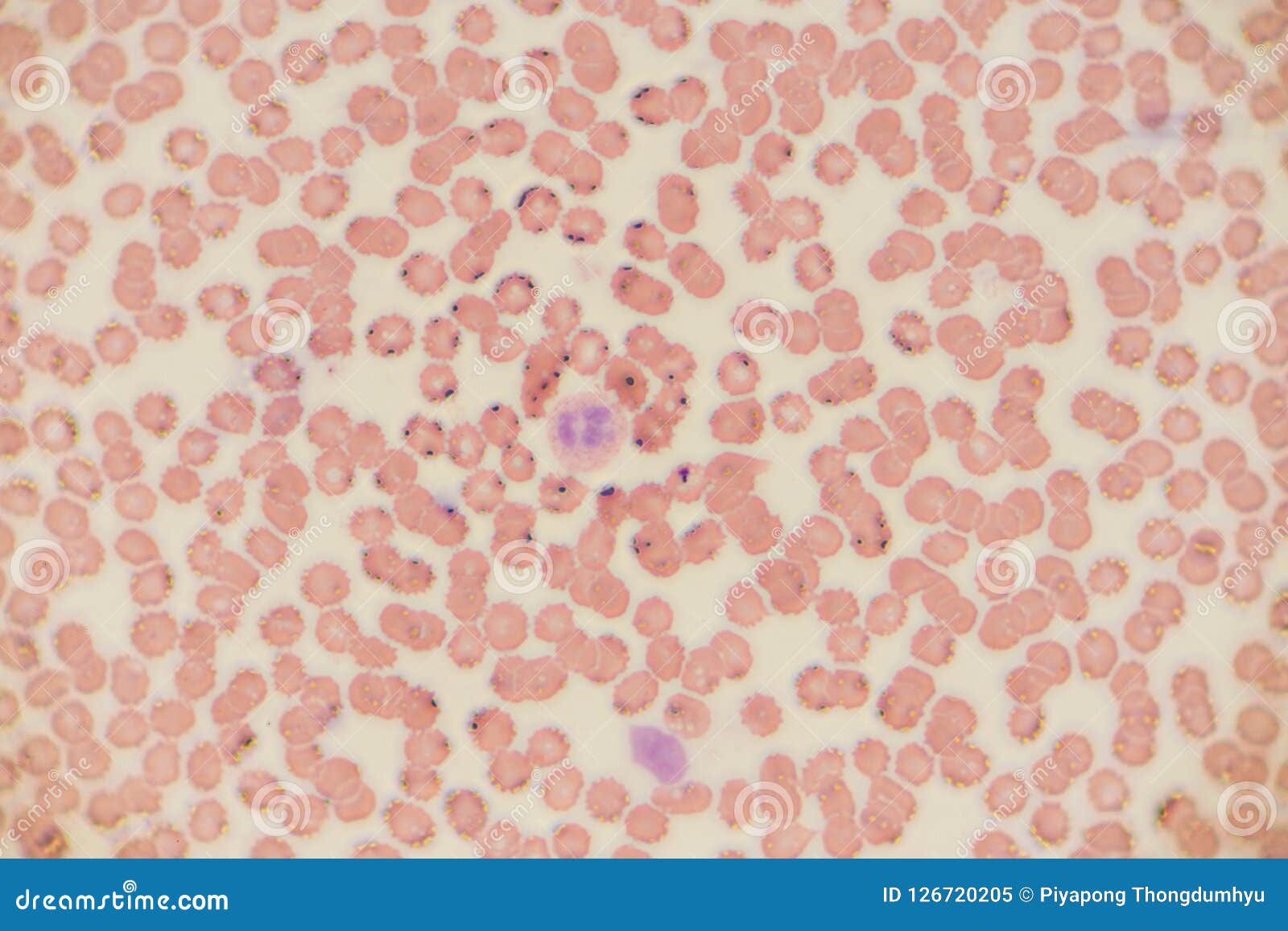 Study of White Blood Cells are the Cells of the Immune System Under the ...