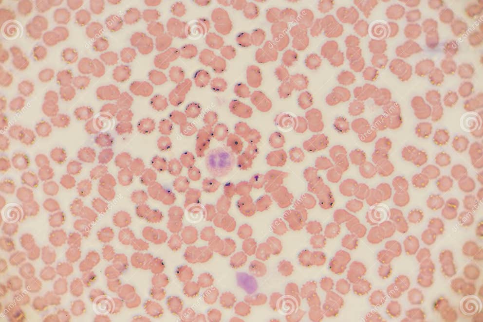 Study of White Blood Cells are the Cells of the Immune System Under the ...