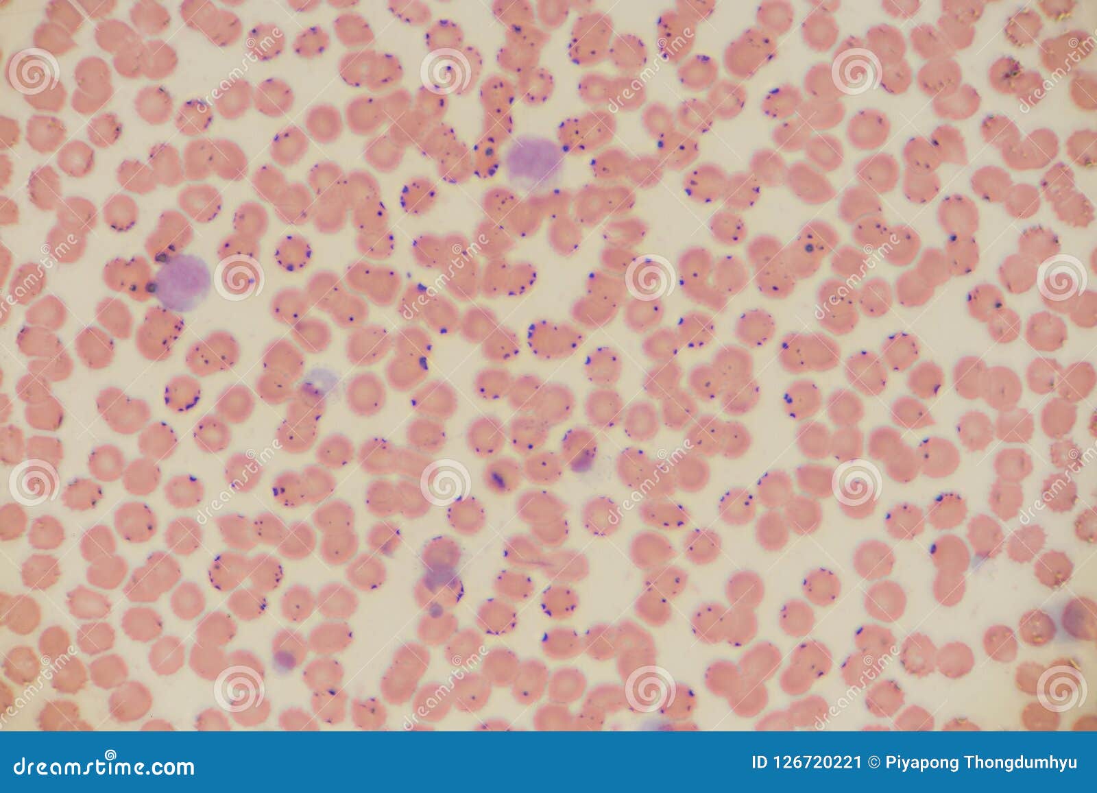 Study of White Blood Cells are the Cells of the Immune System Under the ...