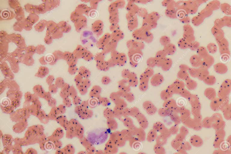 Study of White Blood Cells are the Cells of the Immune System Under the ...