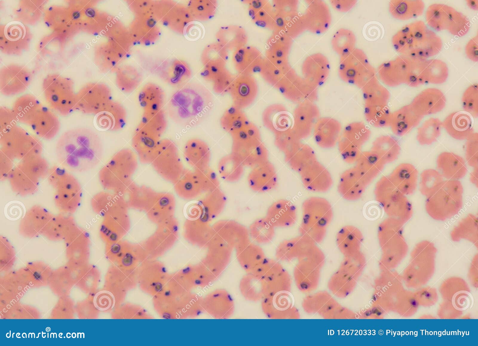 Study of White Blood Cells are the Cells of the Immune System Under the ...